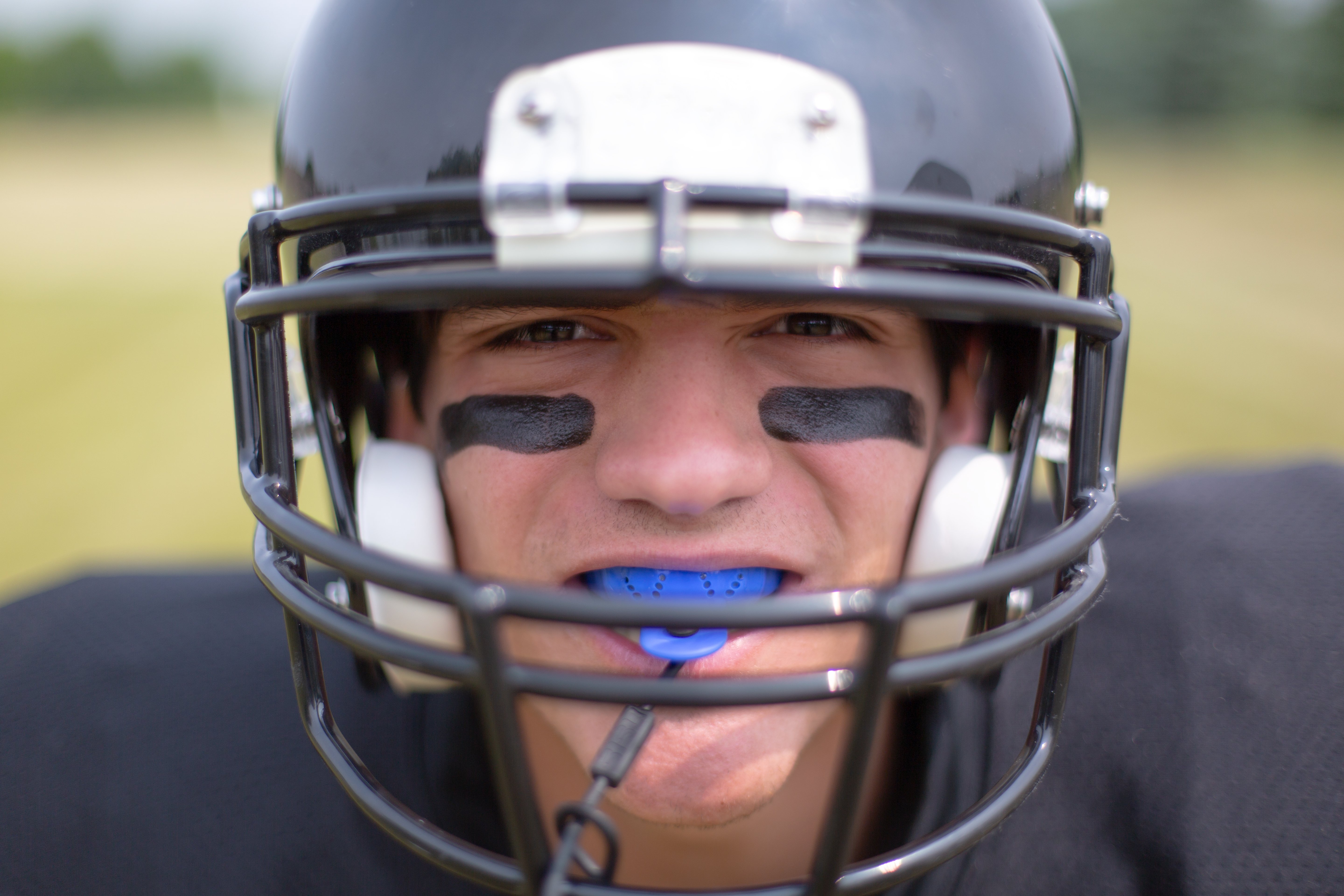 Why a mouthguard tether?